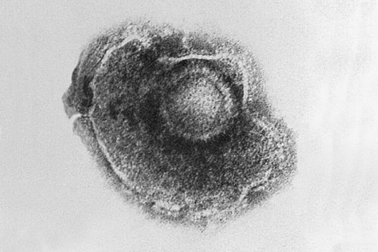 Doctor’s Note: Shingles Virus, a Sleeper Cell in the Back | The ...